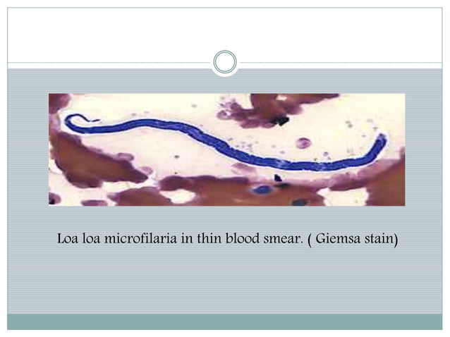 Loa loa | PPTX