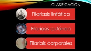 filariasis Loa loa (loiasis) | PPTX