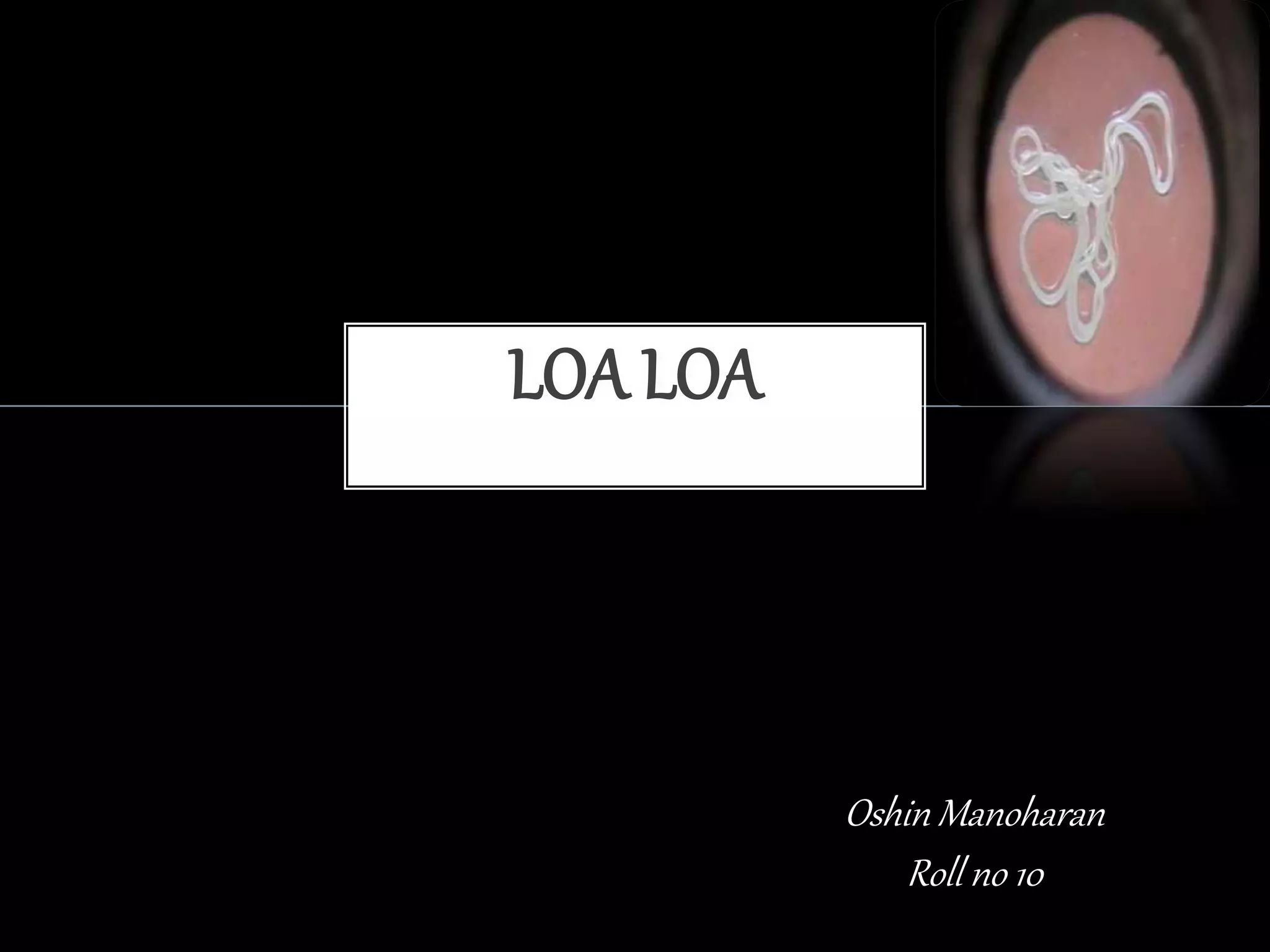 Loa loa parasitology | PPTX