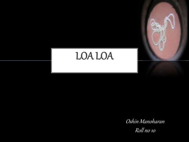 Loa loa parasitology | PPTX