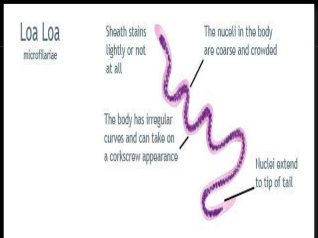 Loa loa parasitology | PPTX