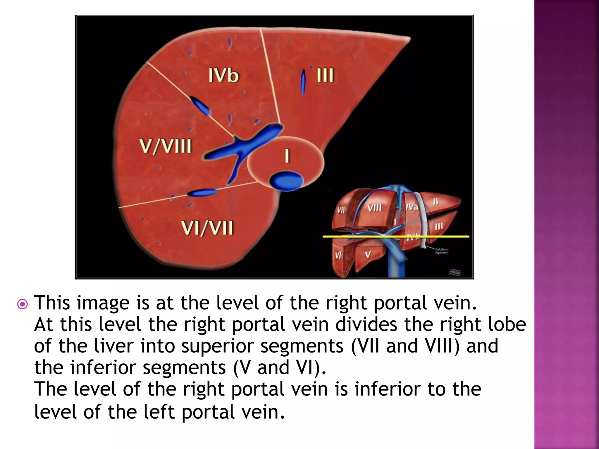 lobar anatomy liver radiology.pptx