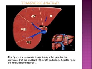 lobar anatomy liver radiology.pptx