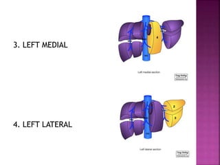 lobar anatomy liver radiology.pptx