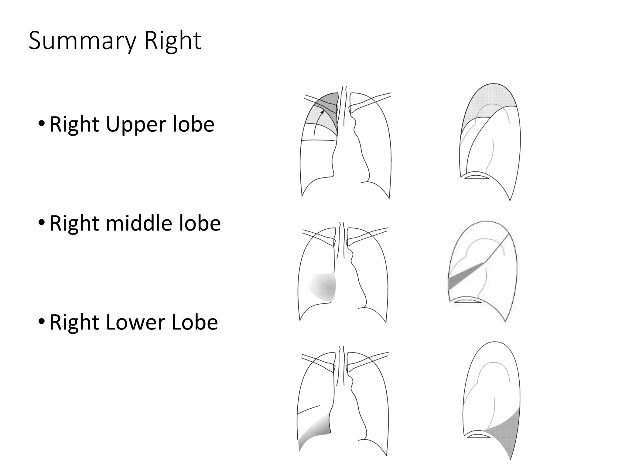 lobar collapse xray.pptx