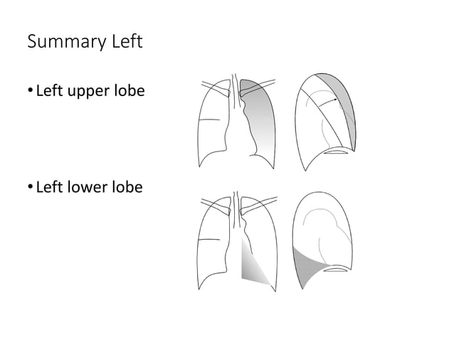 lobar collapse xray.pptx