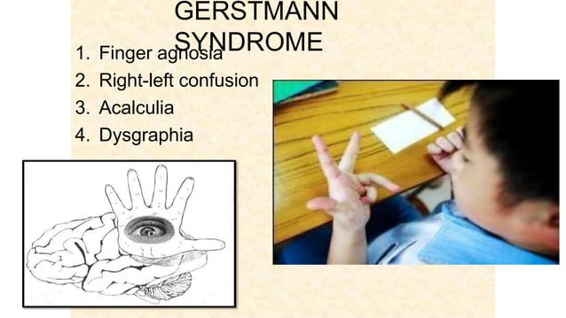 Frontal and Parietal Lobe sign | PPTX