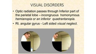 Frontal and Parietal Lobe sign | PPTX