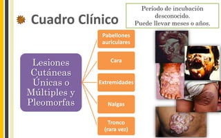 Lobomicosis | PPTX