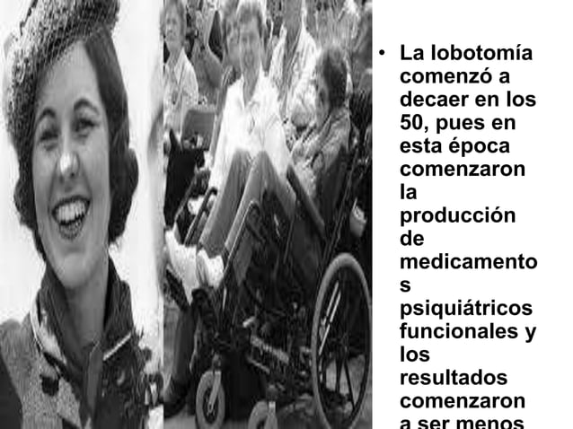 Lobotomia transorbital | PPT