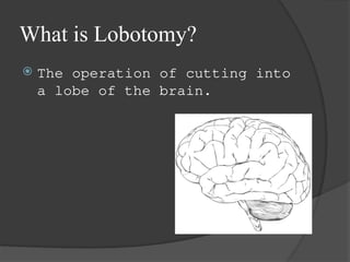 lobotomy-100602112033-phpapp02 share.pptx