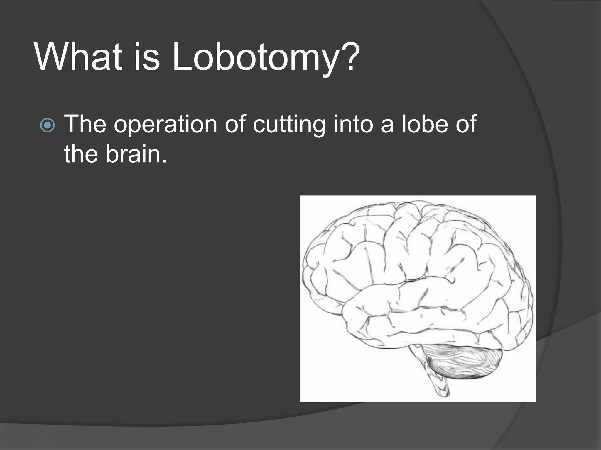 Lobotomy | PPTX
