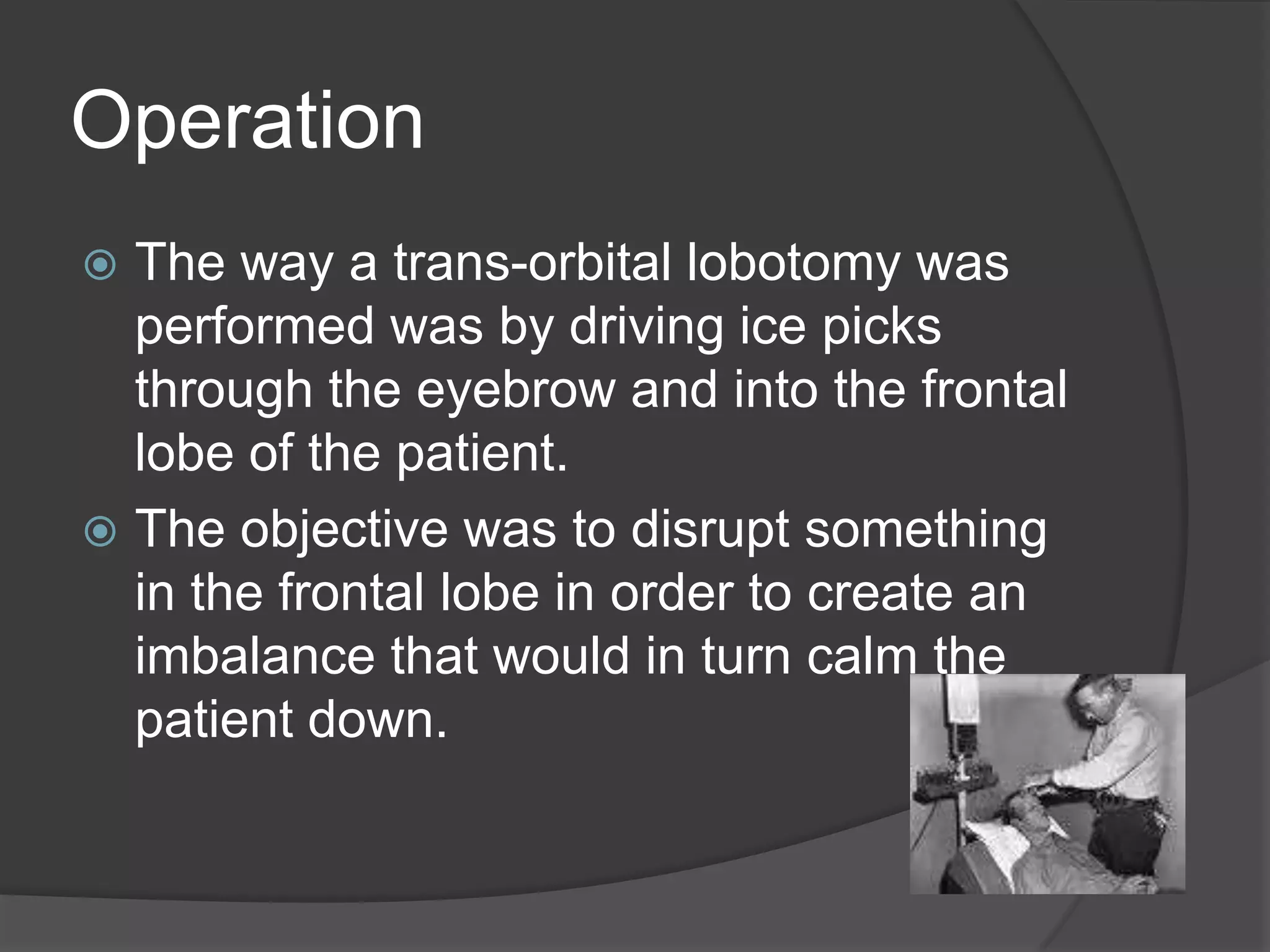 Lobotomy | PPTX