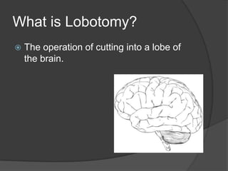 Lobotomy Diagram