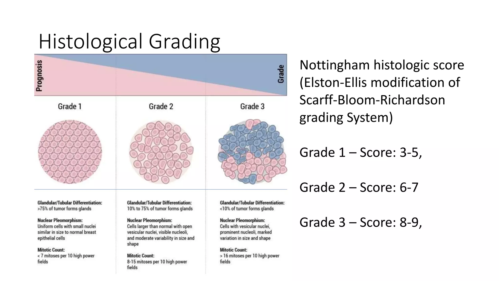 Lobular carcinoma of breast | PPTX