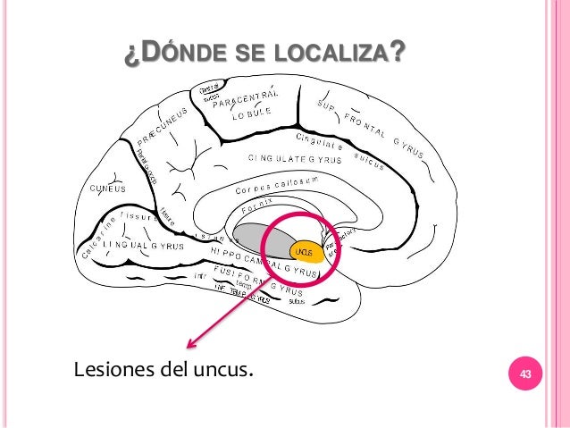 Lóbulo temporal- Inst. Nuestra Sra. de la Paz.