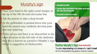 Local abdominal examination | PPTX