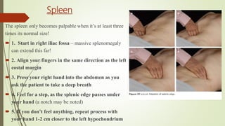 Local abdominal examination | PPTX