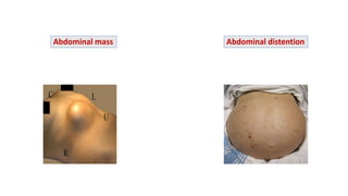 Local abdominal examination | PPTX