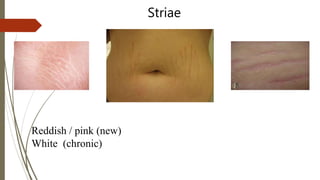 Local abdominal examination | PPTX