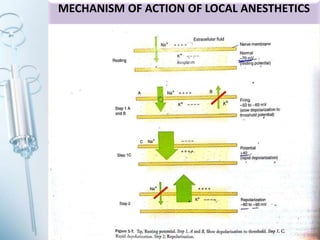 "LOCAL-ANAESTHESIA" | PPT