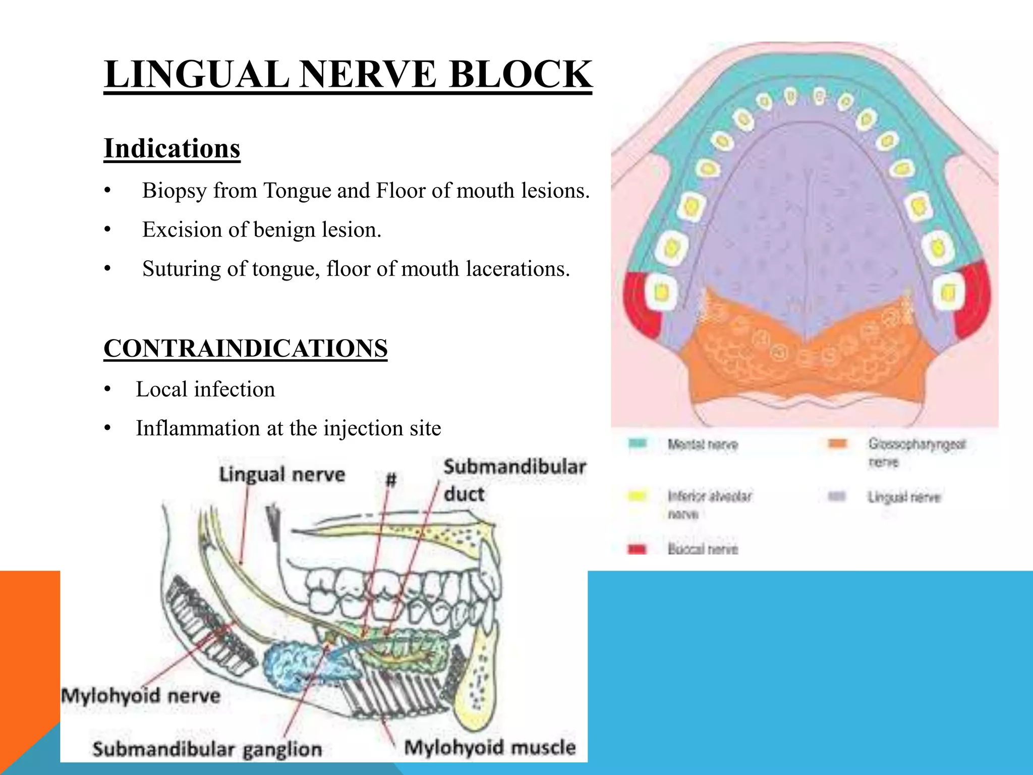 Local anaesthesia blocks in ent | PPTX