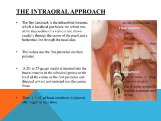 Local anaesthesia blocks in ent | PPTX