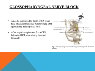 Local anaesthesia blocks in ent | PPTX