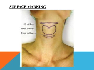Local anaesthesia blocks in ent | PPTX