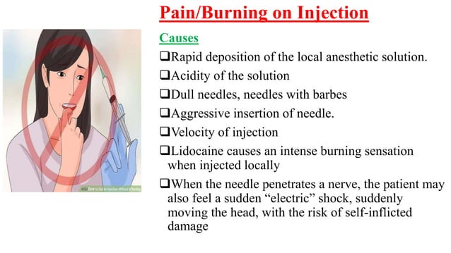 Local anaesthesia complications | PPT
