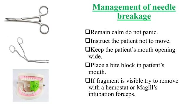 Local anaesthesia complications | PPT