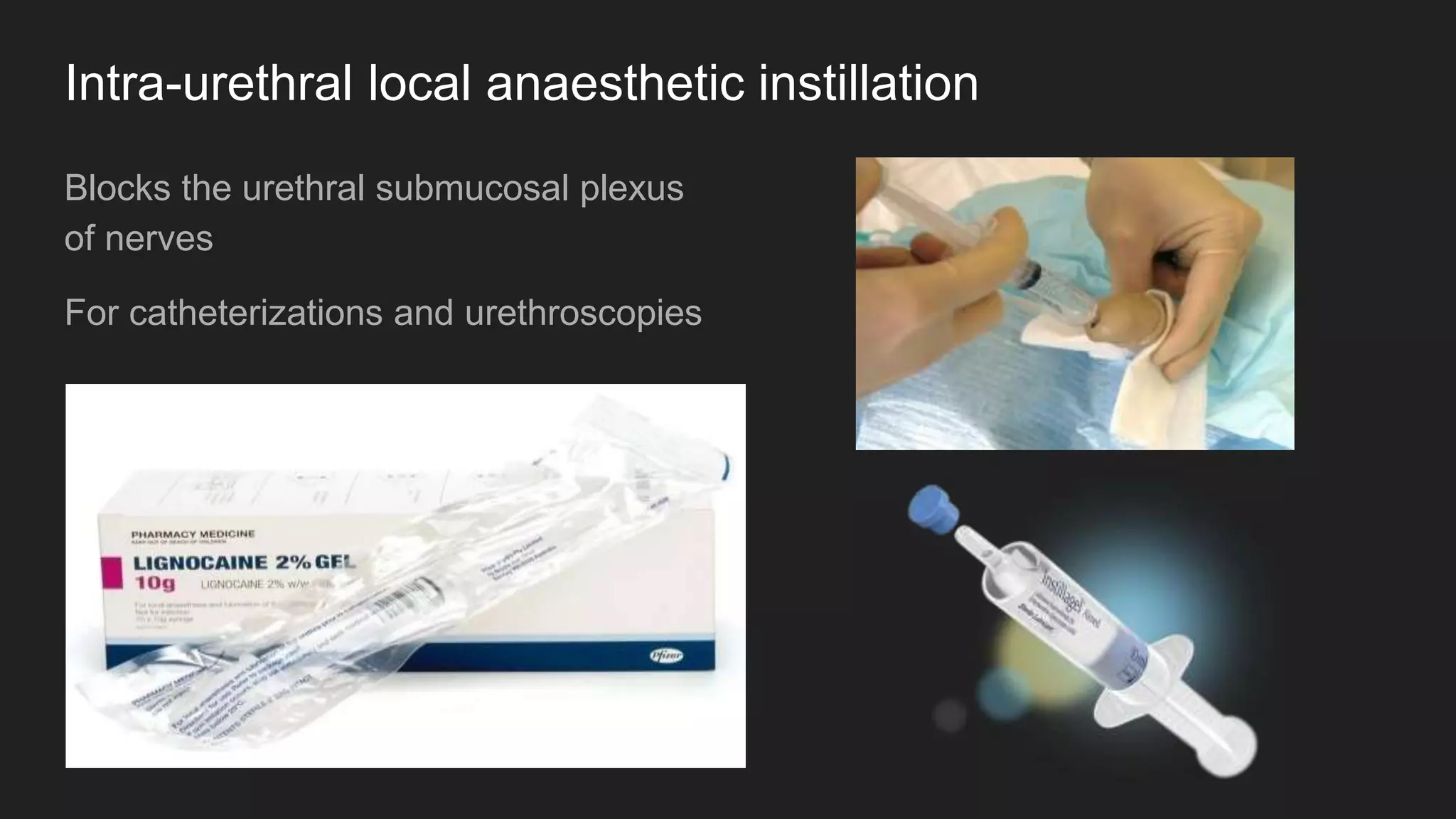 Local anaesthesia for penile procedures | PPTX