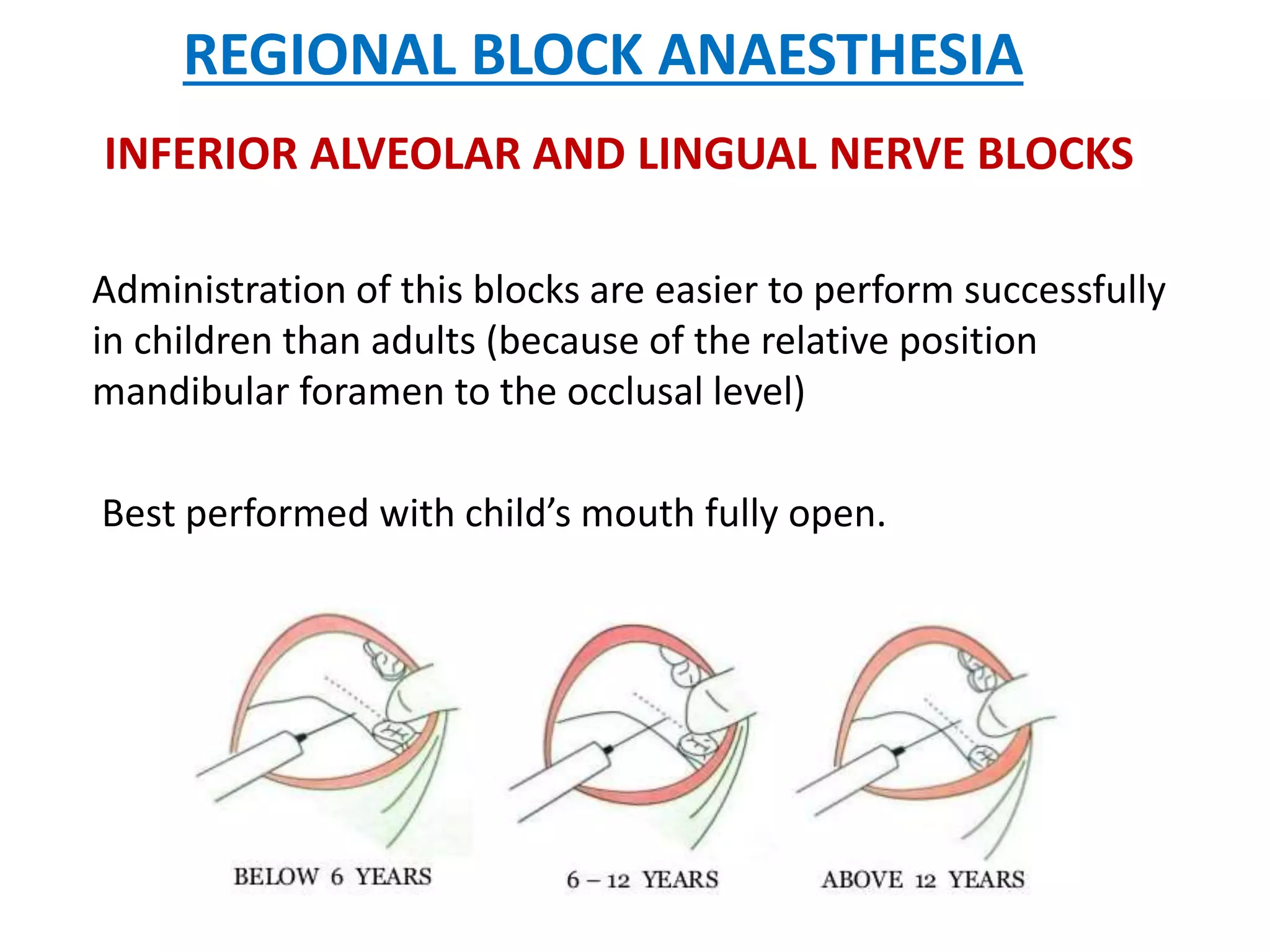 Local anaesthesia for children (dentistry) | PPTX