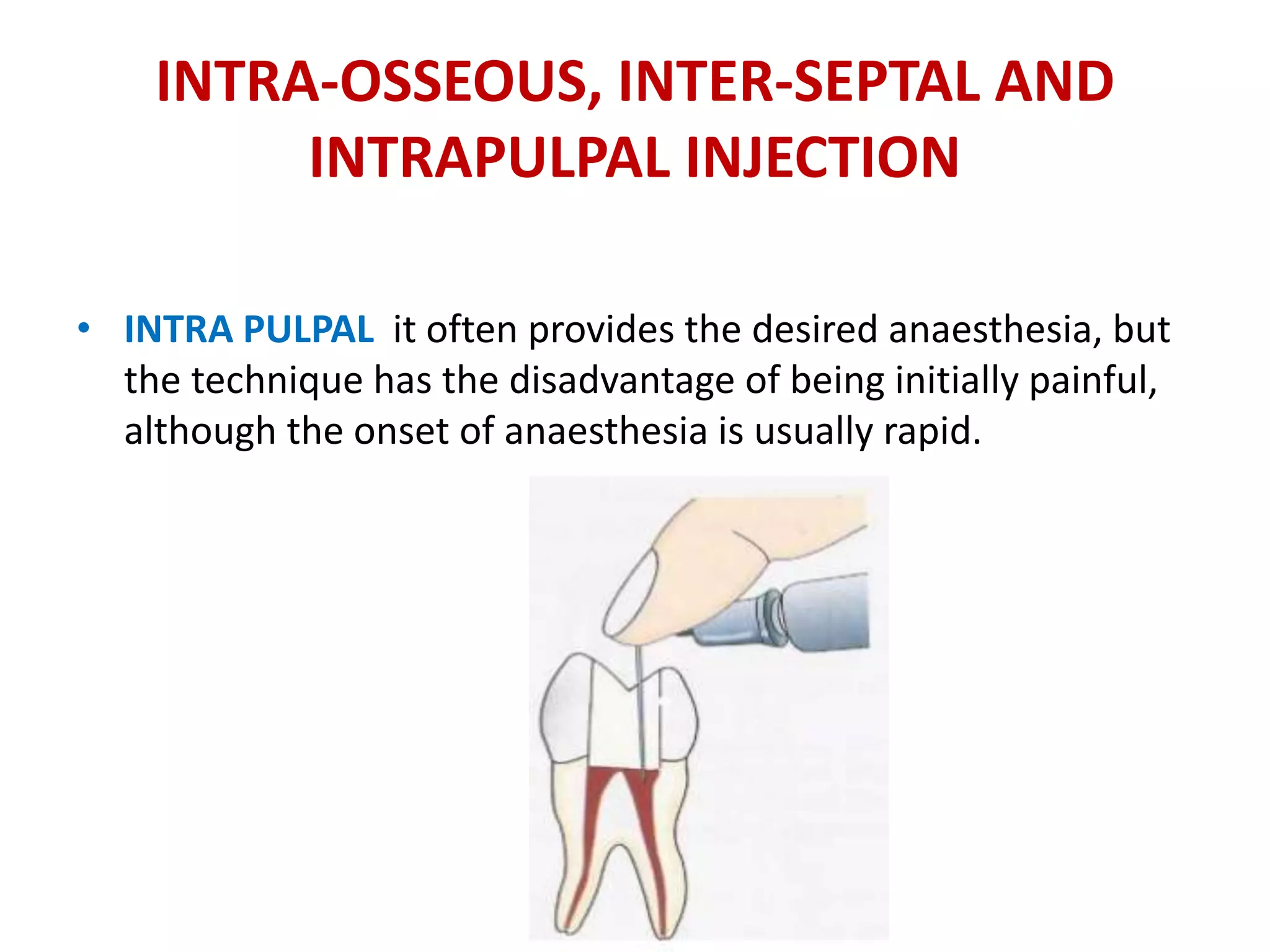 Local anaesthesia for children (dentistry) | PPTX