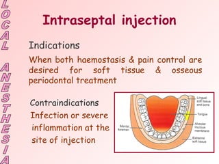 Local anaesthesia _pedo_ | PPT