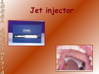 Local anaesthesia _pedo_ | PPT