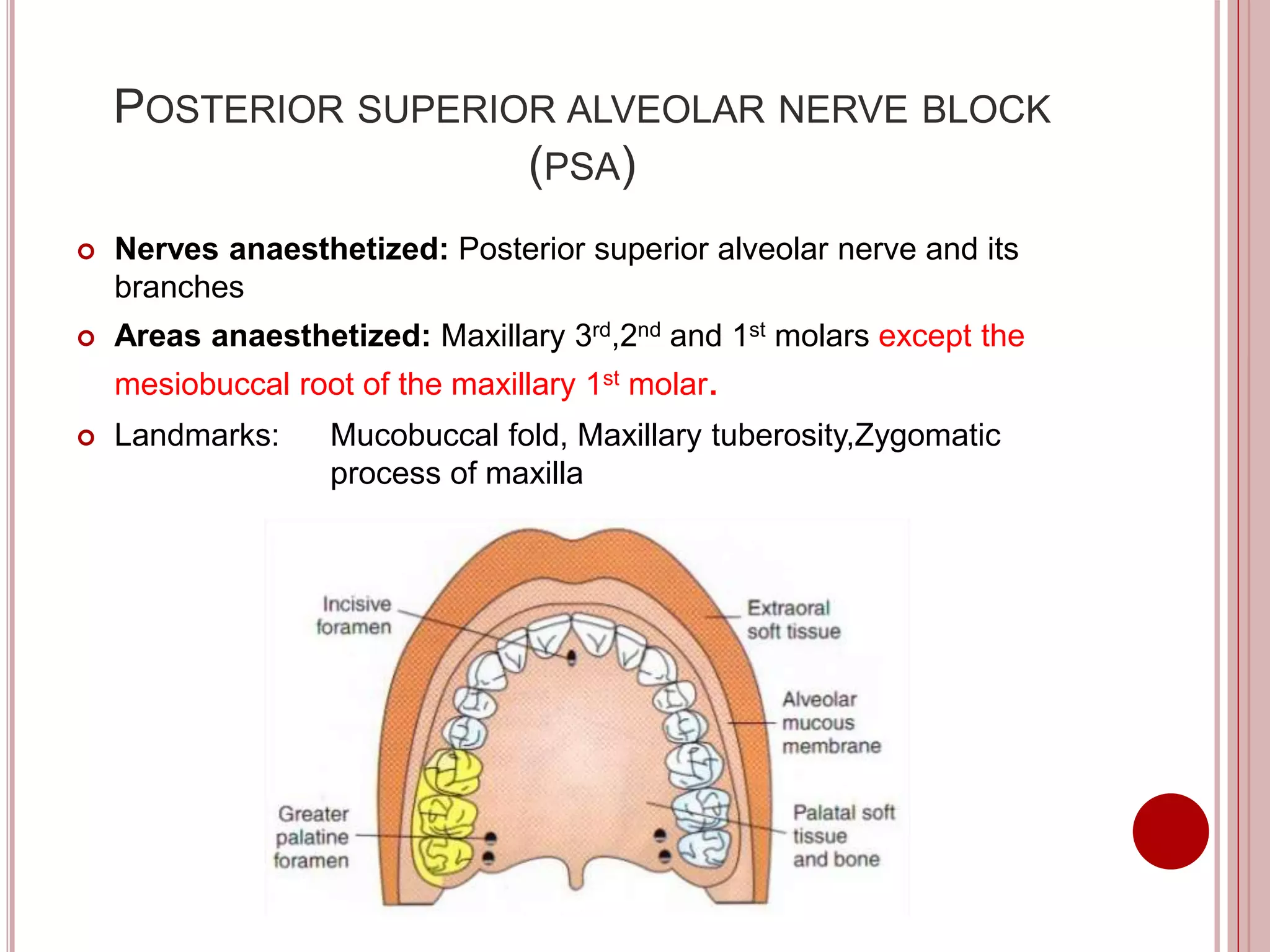 Local anaesthesia in dentistry | PPTX