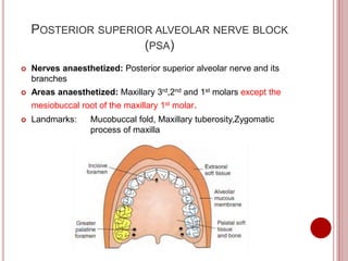 Local anaesthesia in dentistry | PPTX