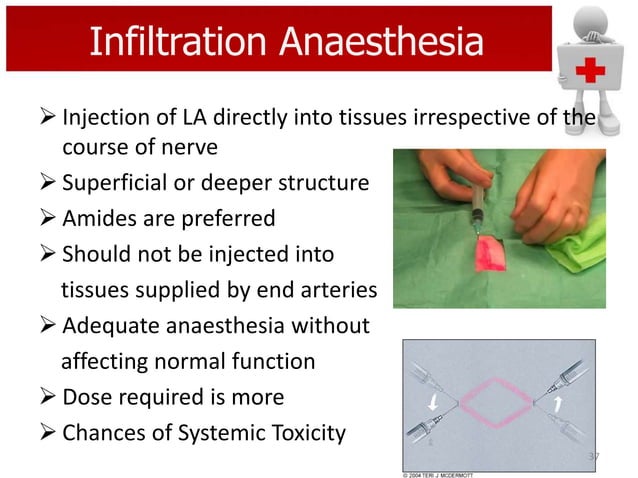 Local anaesthetics | PPT