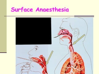 Local anaesthetics | PPT