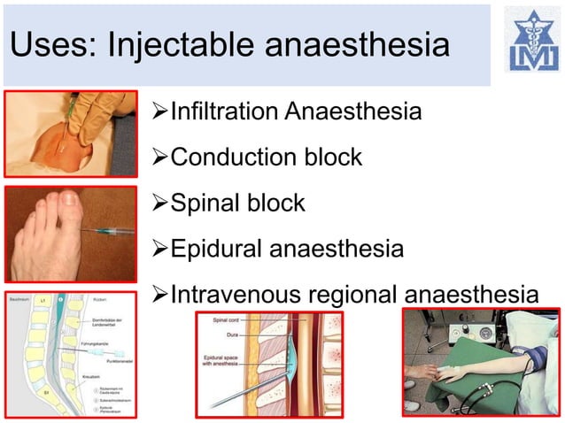 Local anaesthetics 2 | PPT