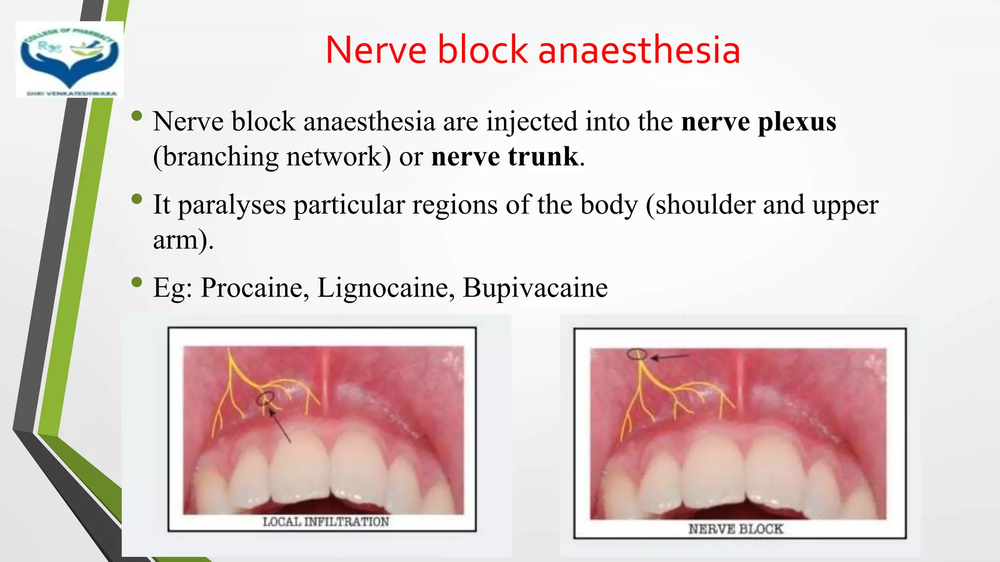 Local anaesthetics | PPTX