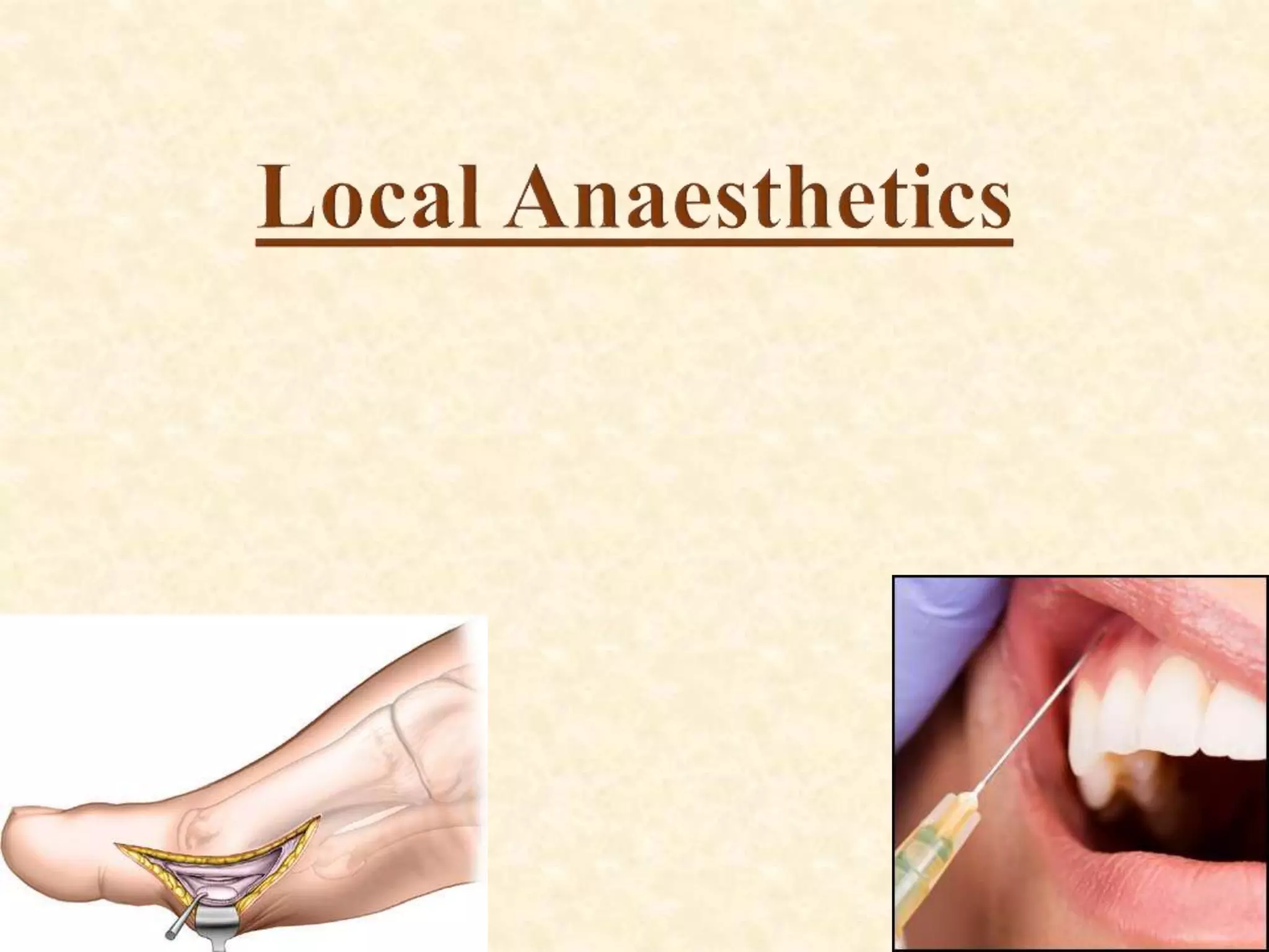 Local anaesthetic agents | PPTX