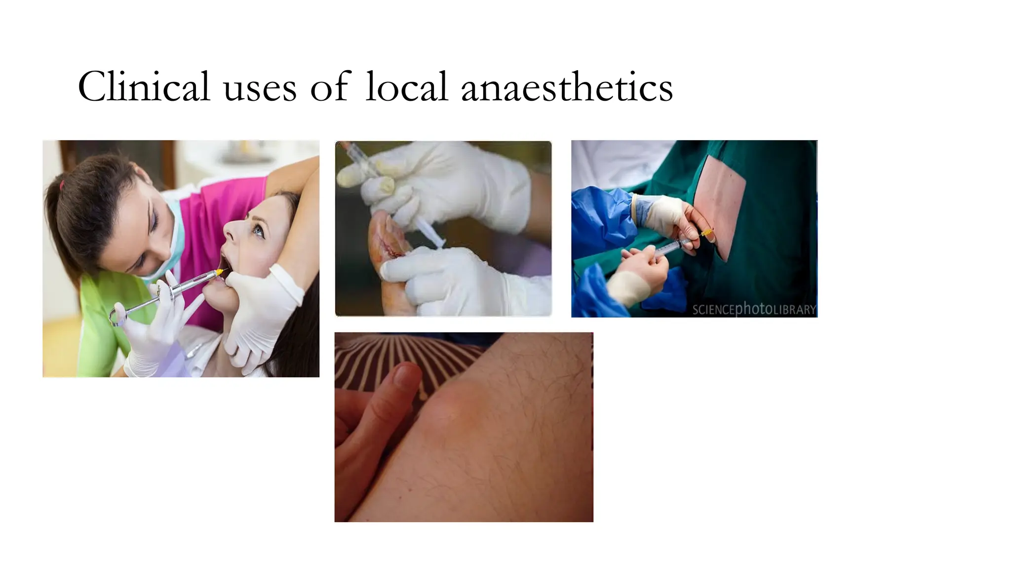 presentation by power point Local Anaesthetics.pptx