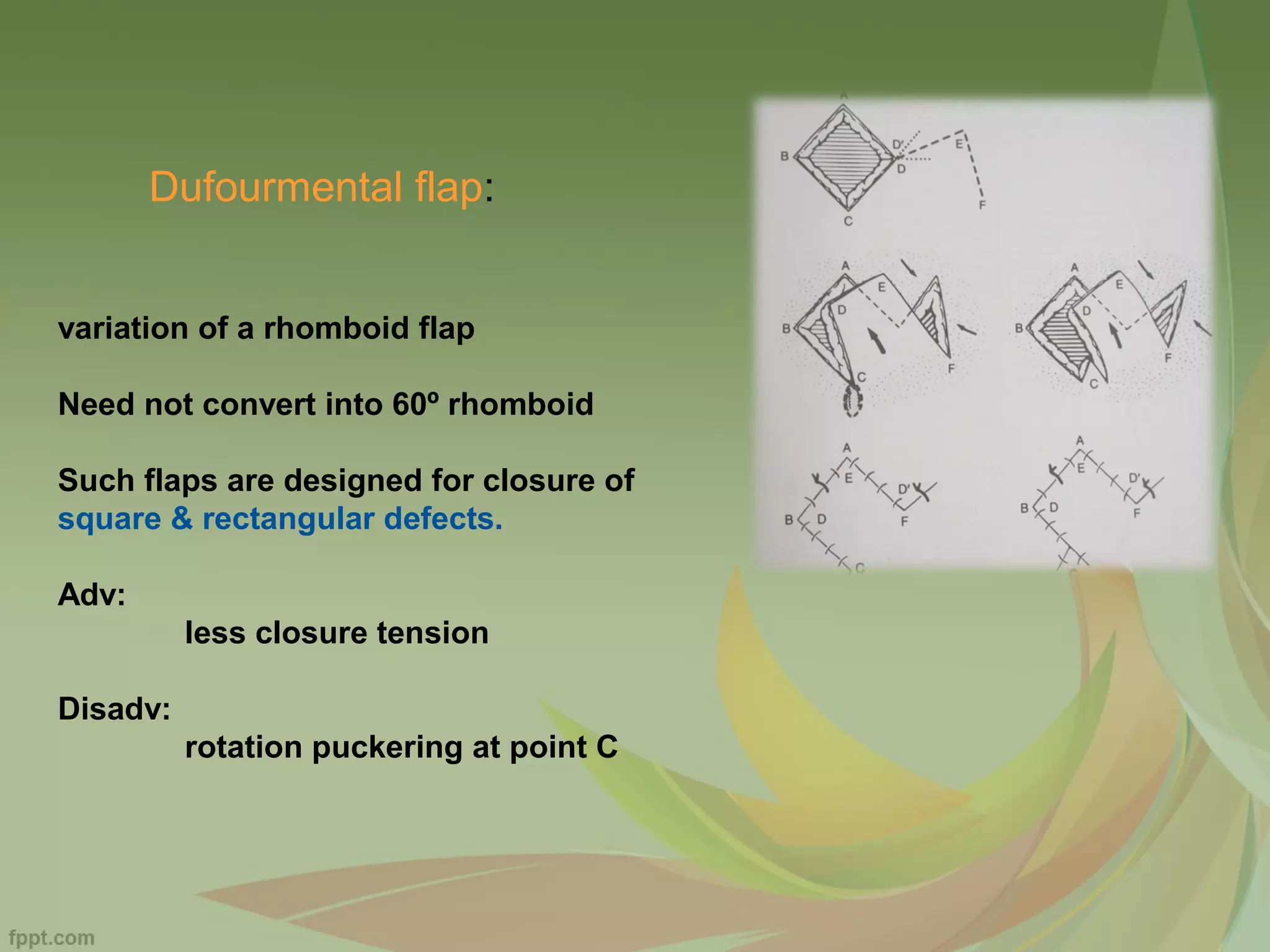 Local flaps in head & neack reconstruction | PPT