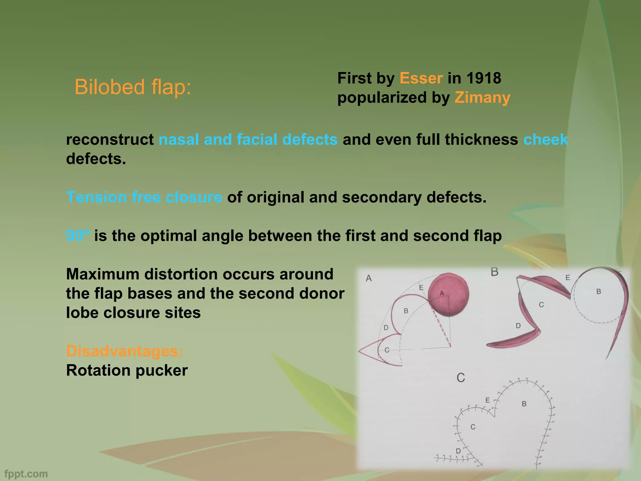 Local flaps in head & neack reconstruction | PPT