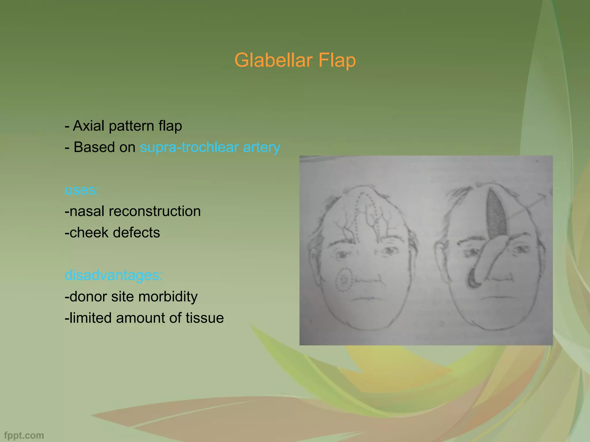 Local flaps in head & neack reconstruction | PPT