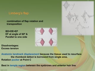 Local flaps in head & neack reconstruction | PPT