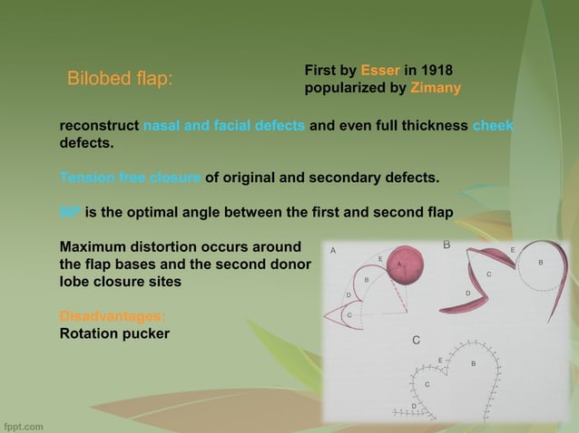 Local flaps in head & neack reconstruction | PPT | First Aid | Injuries