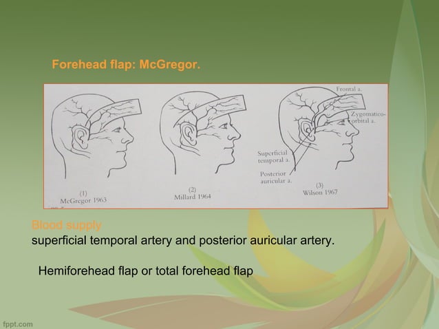 Local flaps in head & neack reconstruction | PPT | First Aid | Injuries